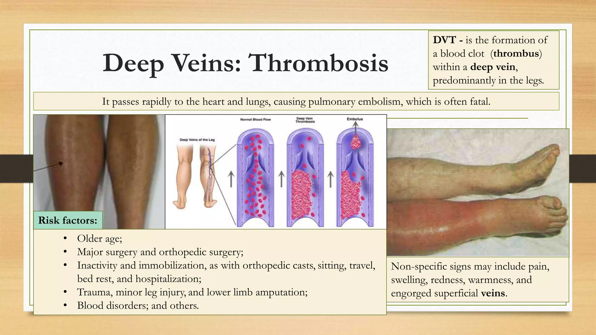 Leg: from anatomy to orthopedisc | PPTX