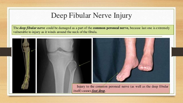 Leg: from anatomy to orthopedisc