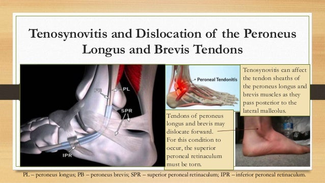 Leg: from anatomy to orthopedisc