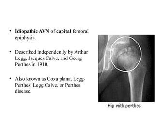 Legg-Calve-Perthes disease of the lower limb.pptx