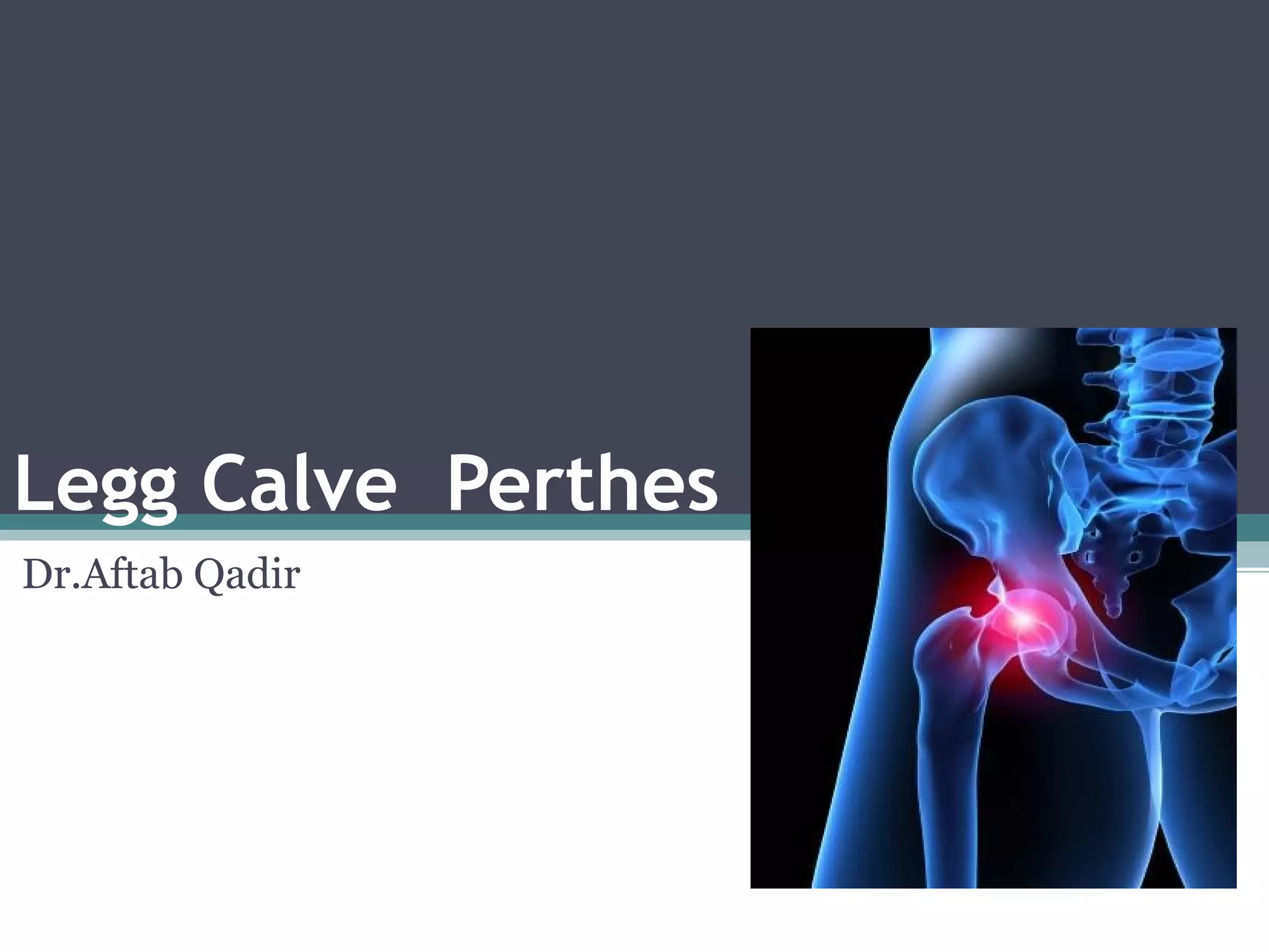 Legg calve perthes | PPT