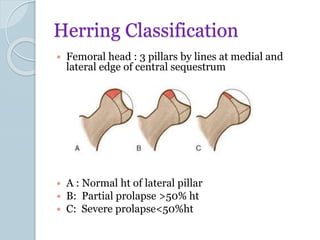 Legg calve perthes disease | PPTX