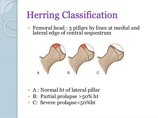 Legg calve perthes disease