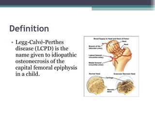Legg+Calve+Perthes+Disease | PPT