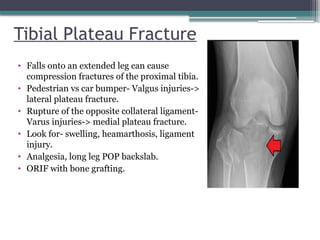 leg injuries in emergency medicinee.pptx