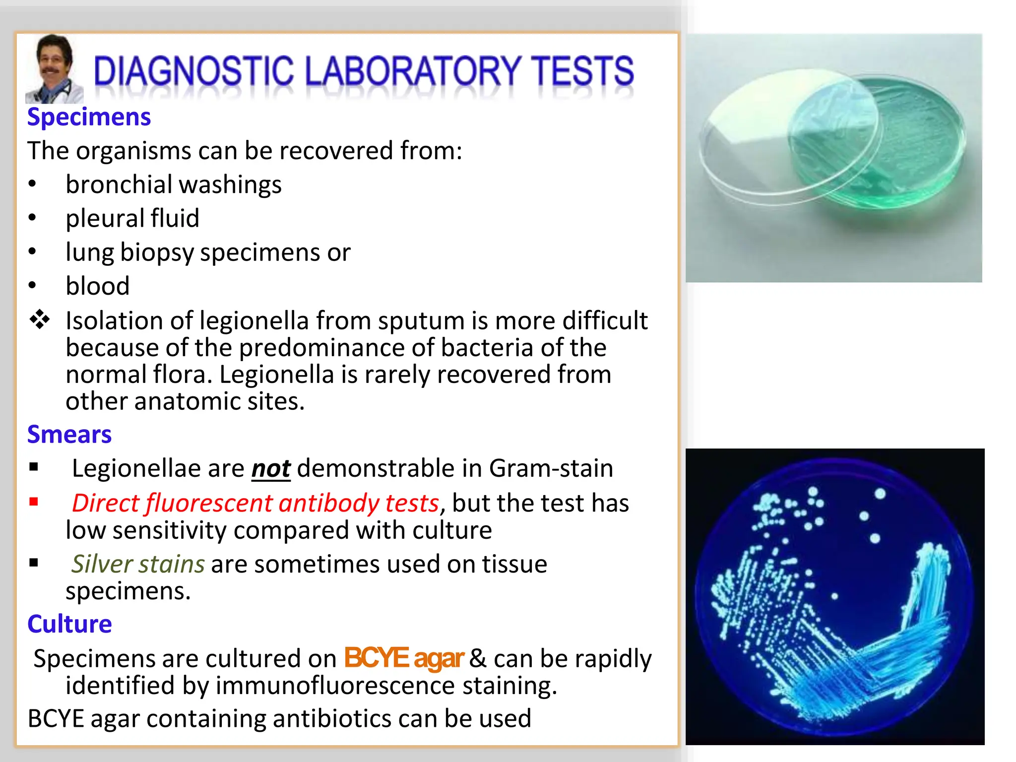 legionella, microbiology, bacteriologypptx | PPTX