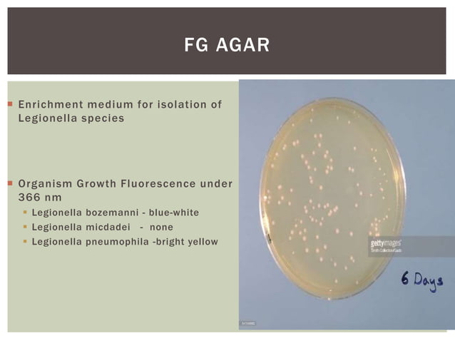 Legionella | PPTX | Infectious Diseases | Diseases and Conditions