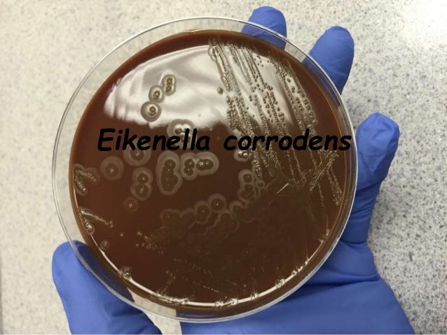 Legionella, eikenella, cardiobacterium