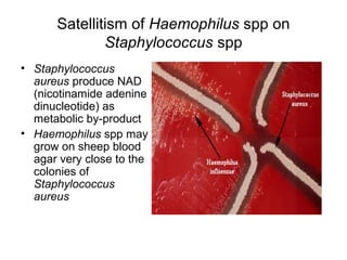 Legionella haemophilus bordetella | PPT