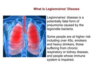 Legionnares Disease Presentation ....... | PDF