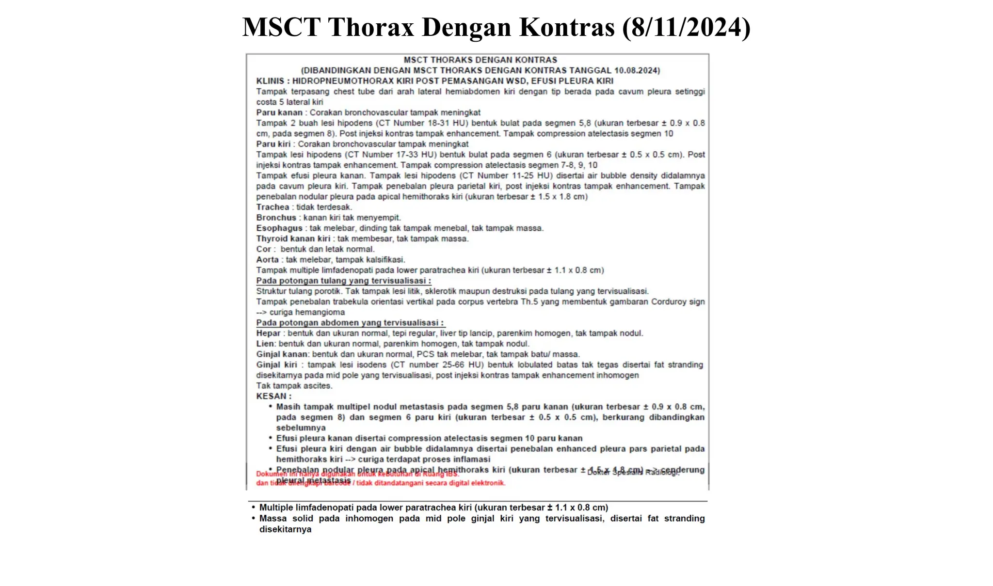 Legiyo - Renal Cell Carcinoma T3bN1 M1, Hipotensi, Hiponatremia (124 ...