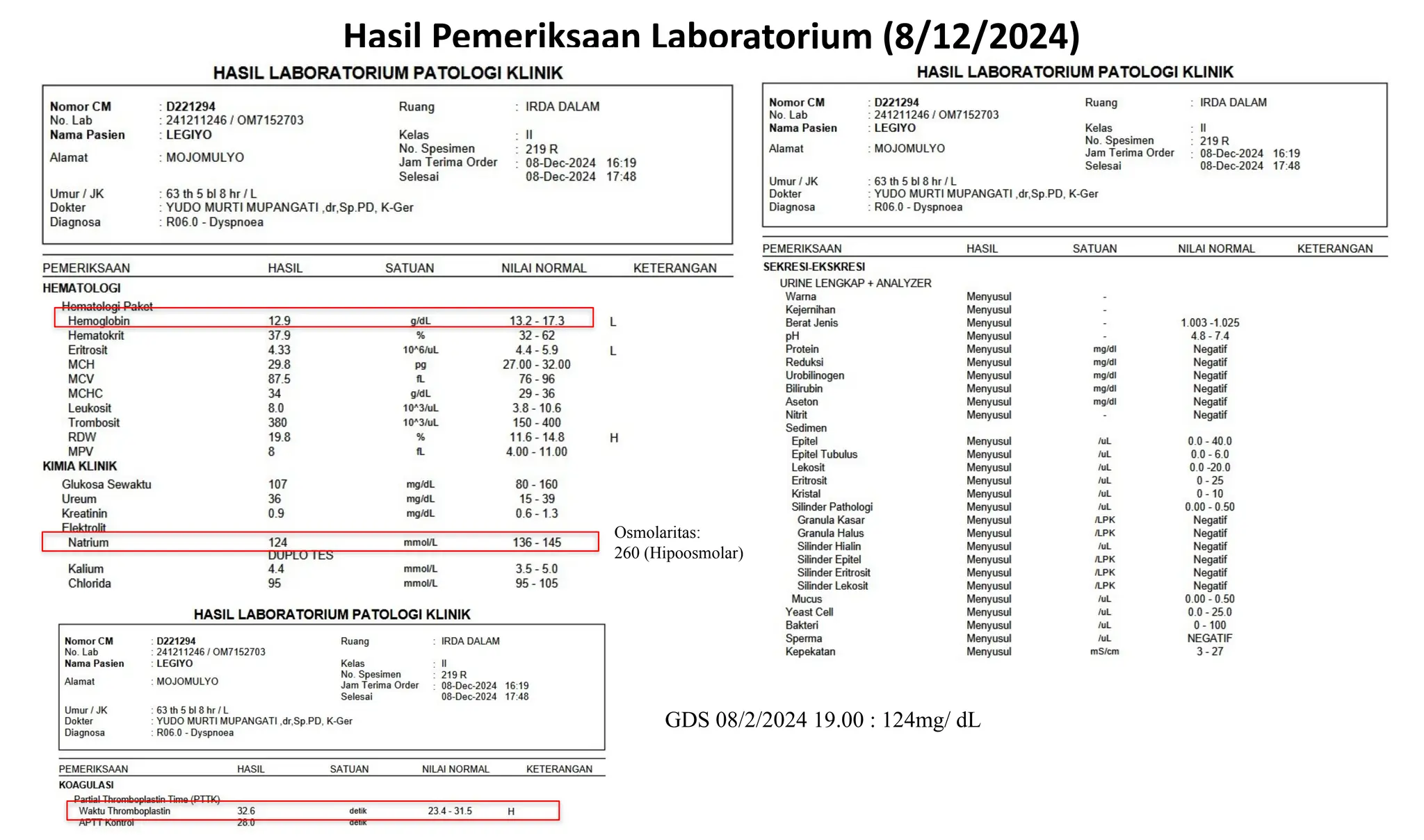 Legiyo - Renal Cell Carcinoma T3bN1 M1, Hipotensi, Hiponatremia (124 ...