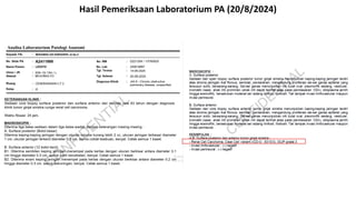 Legiyo - Renal Cell Carcinoma T3bN1 M1, Hipotensi, Hiponatremia (124 ...