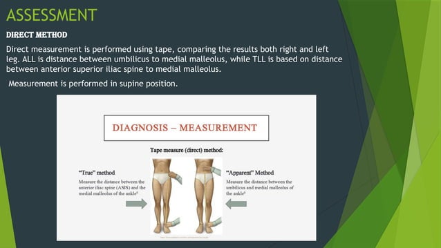 LEG LENGTH DISCREPANCY asessment and management.pptx