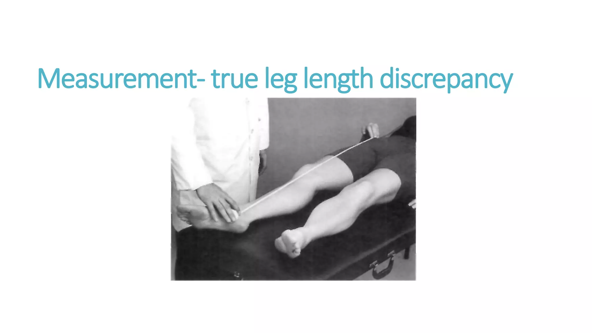 Leg length measurements | PPTX