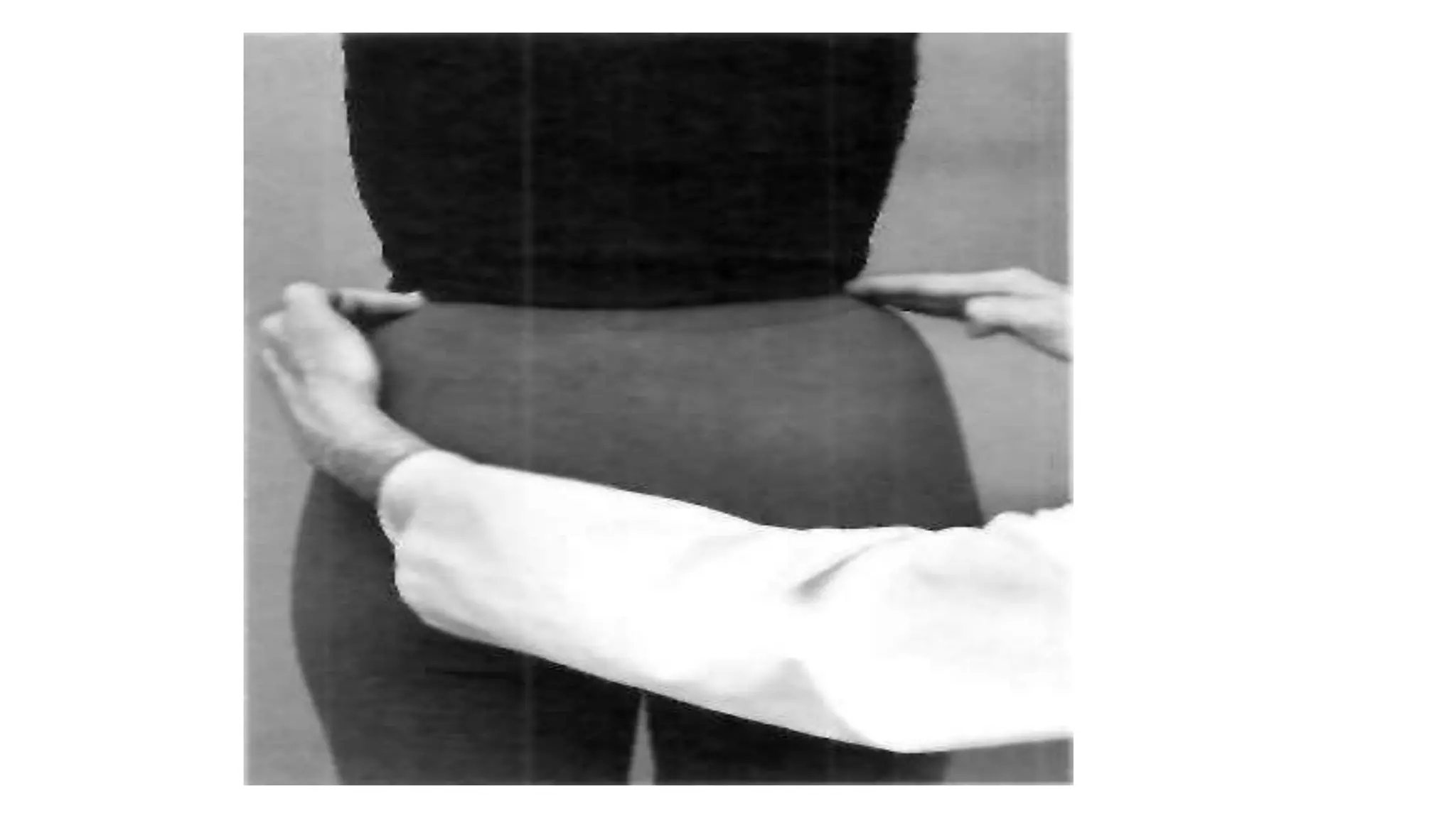 Leg length measurements | PPTX