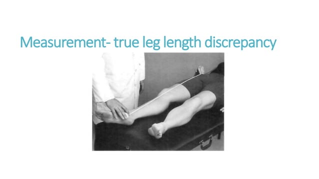 Leg length measurements | PPTX