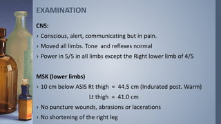 Leg swelling and difficulty breathing - a differential diagnosis. | PPTX