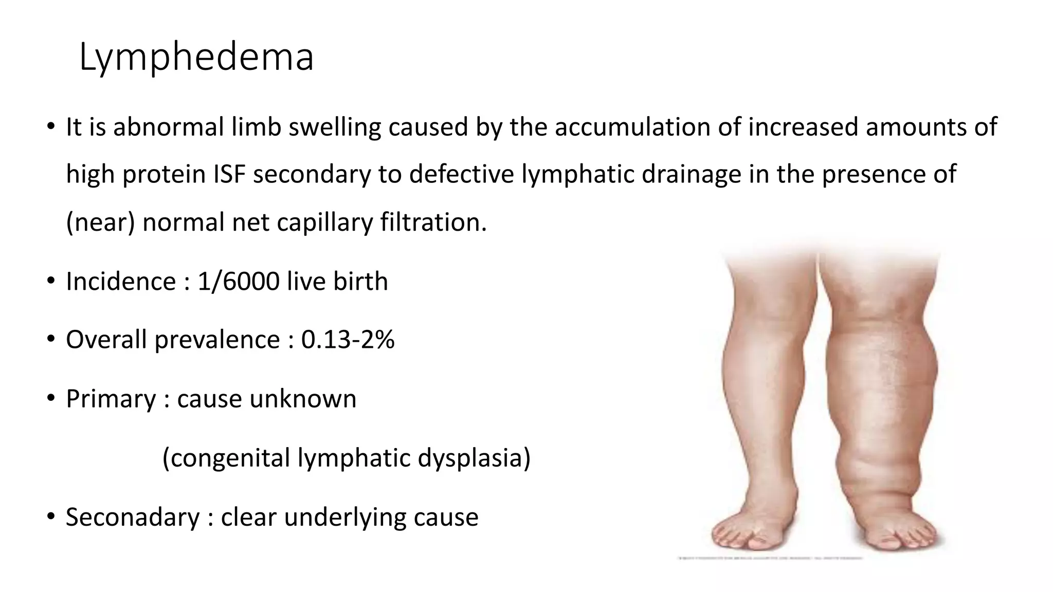seminar on Leg swelling & its causes | PDF