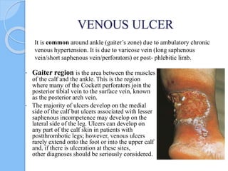 Leg Ulcer.pptx