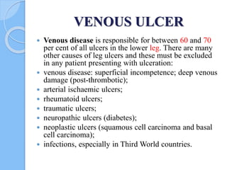 Leg Ulcer.pptx