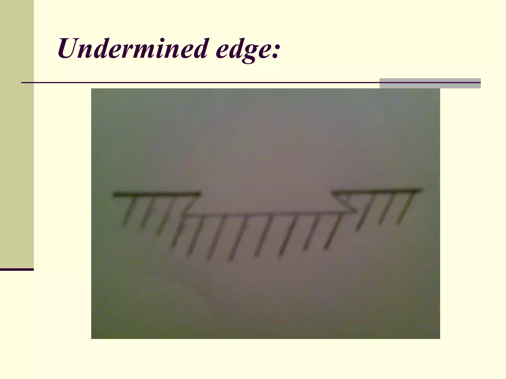 Leg ulcers (chronic | PPTX