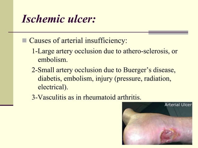 Leg ulcers (chronic | PPTX