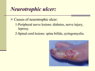 Leg ulcers (chronic | PPTX