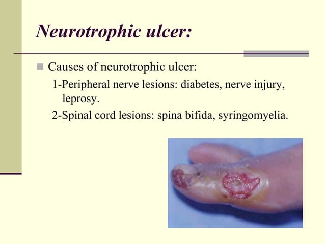 Leg ulcers (chronic | PPTX