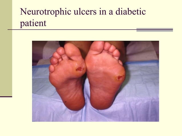 Leg ulcers (chronic | PPTX