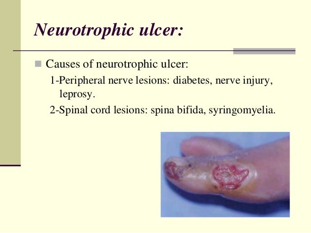 Leg ulcers (chronic