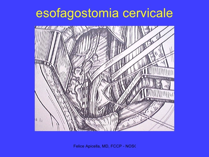 Le Infezioni In Chirurgia Generale