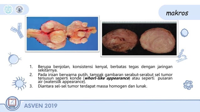 Leiomioma patalogical anatomi medical faculty.pptx