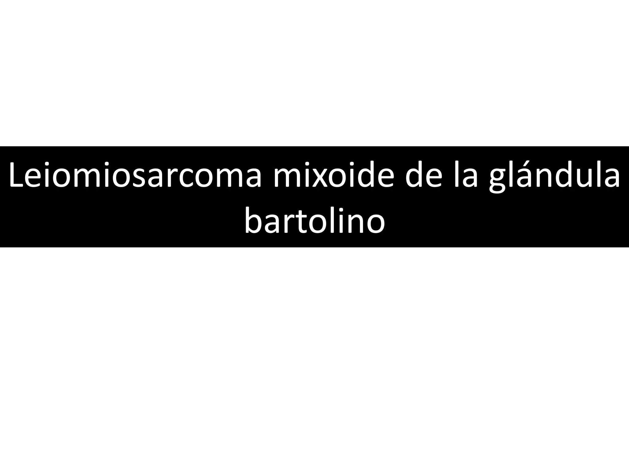 Leiomiosarcoma mixoide de la glándula bartolino | PPTX