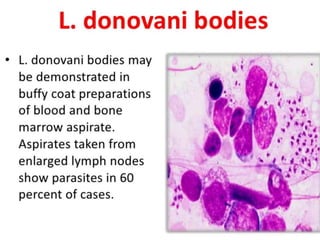 Leishemania donovani | PPT