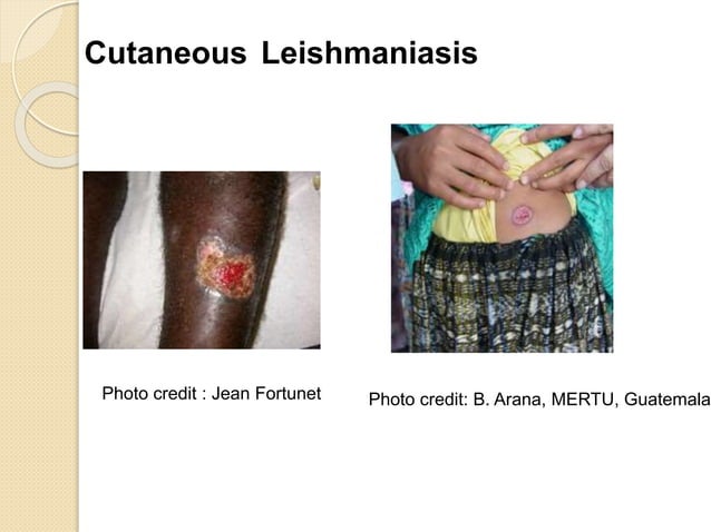 Kinetoplasta (Trypanosoma & Leishmania) | PPTX | Infectious Diseases ...