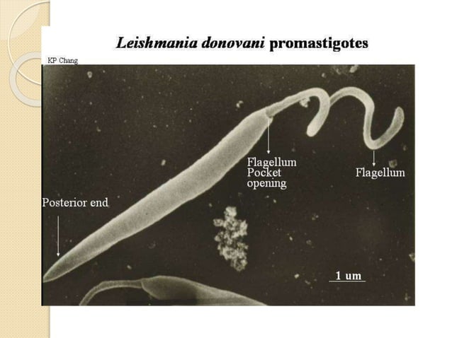 Kinetoplasta (Trypanosoma & Leishmania) | PPTX | Infectious Diseases ...