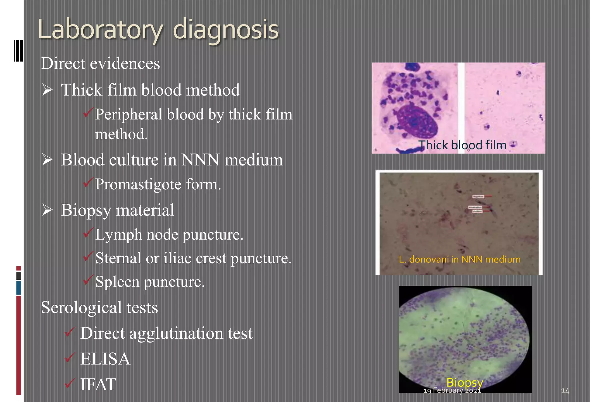 Leishmania donavani presentation | PPTX