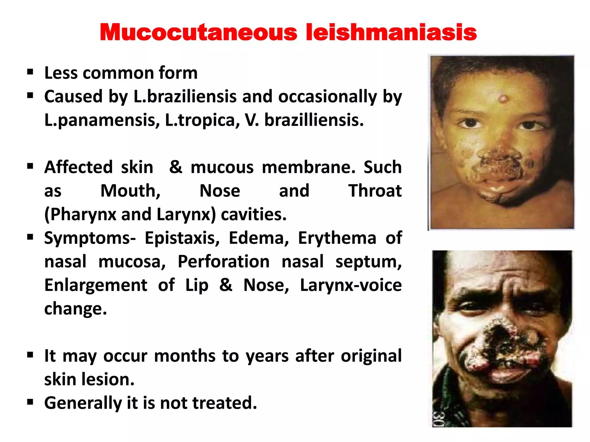 Leishmania donovani | PPTX