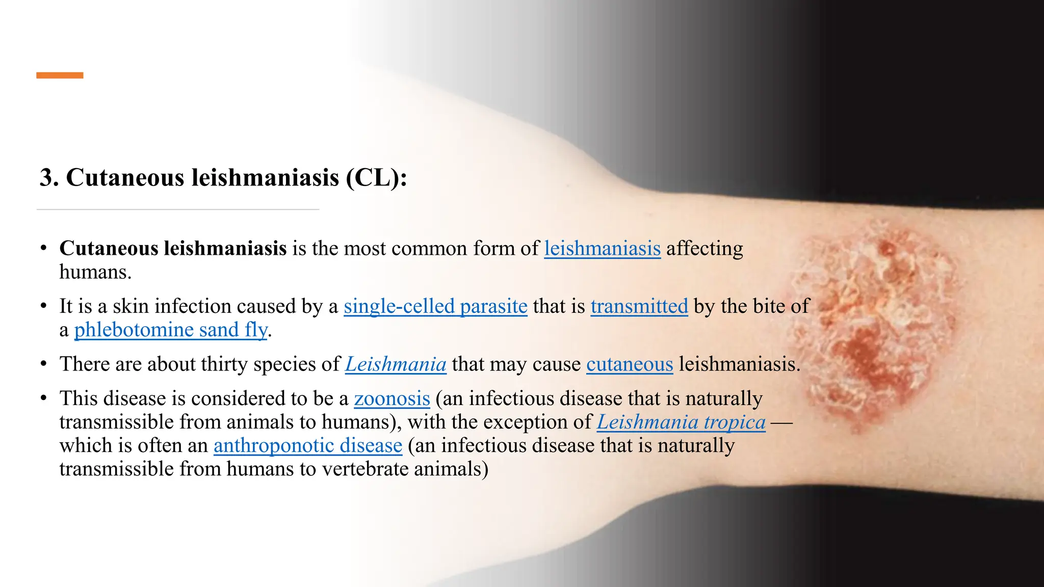 LEISHMANIA DONOVANI .pptx