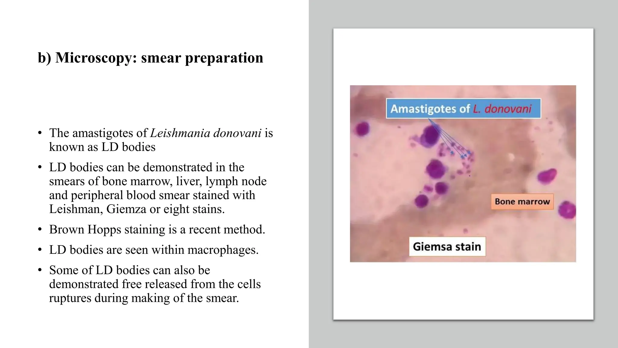 LEISHMANIA DONOVANI .pptx