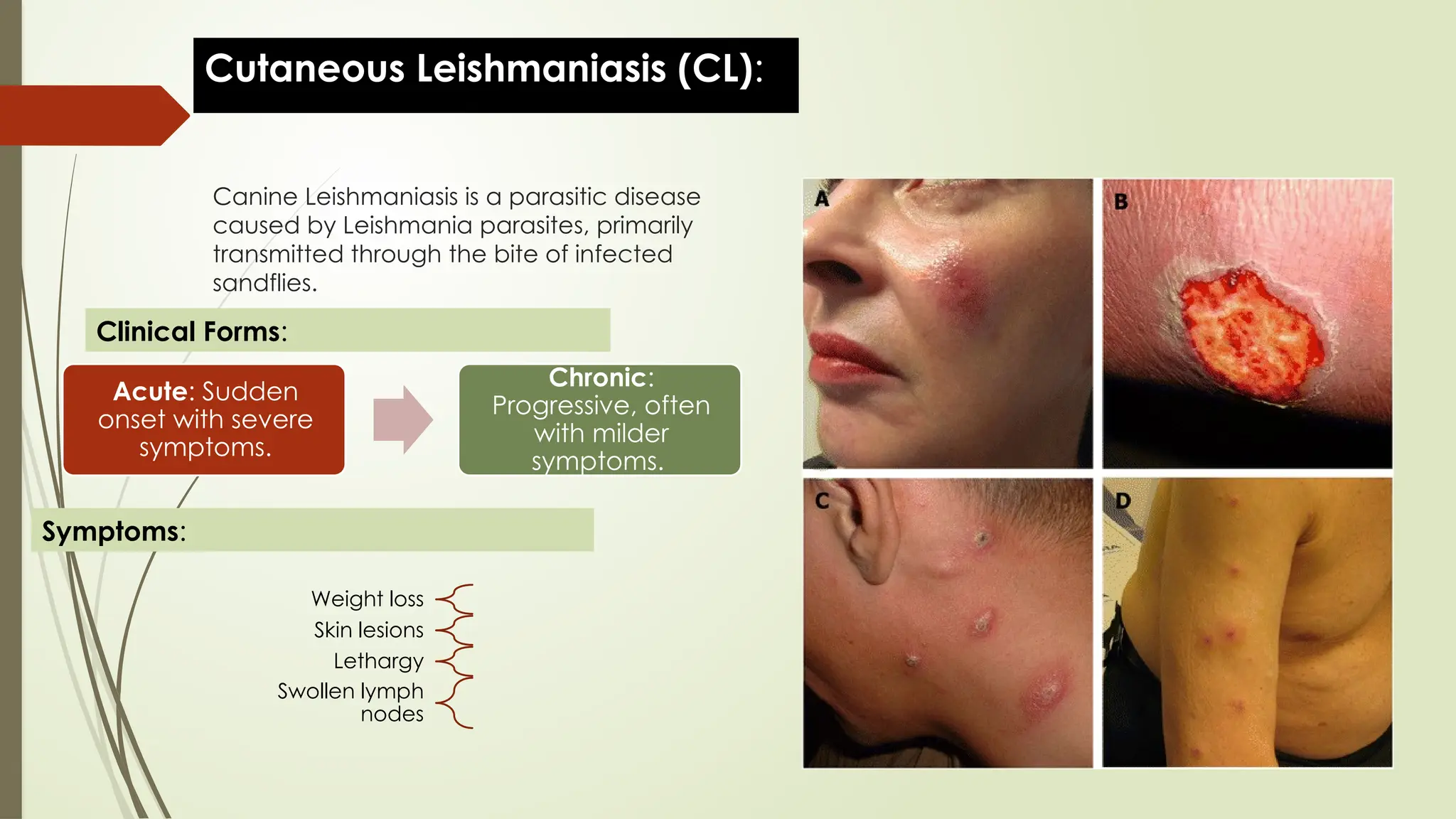 Leishmaniasis is a vector borne, parasitic disease | PPTX
