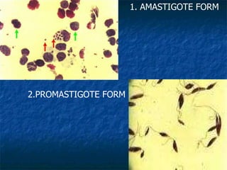 Leishmaniasis | PPT | Infectious Diseases | Diseases and Conditions