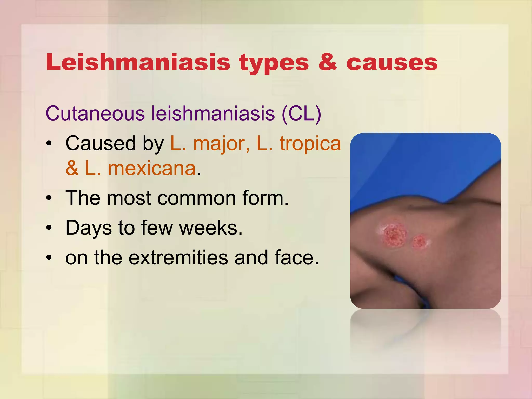 Leishmaniasis | PPTX