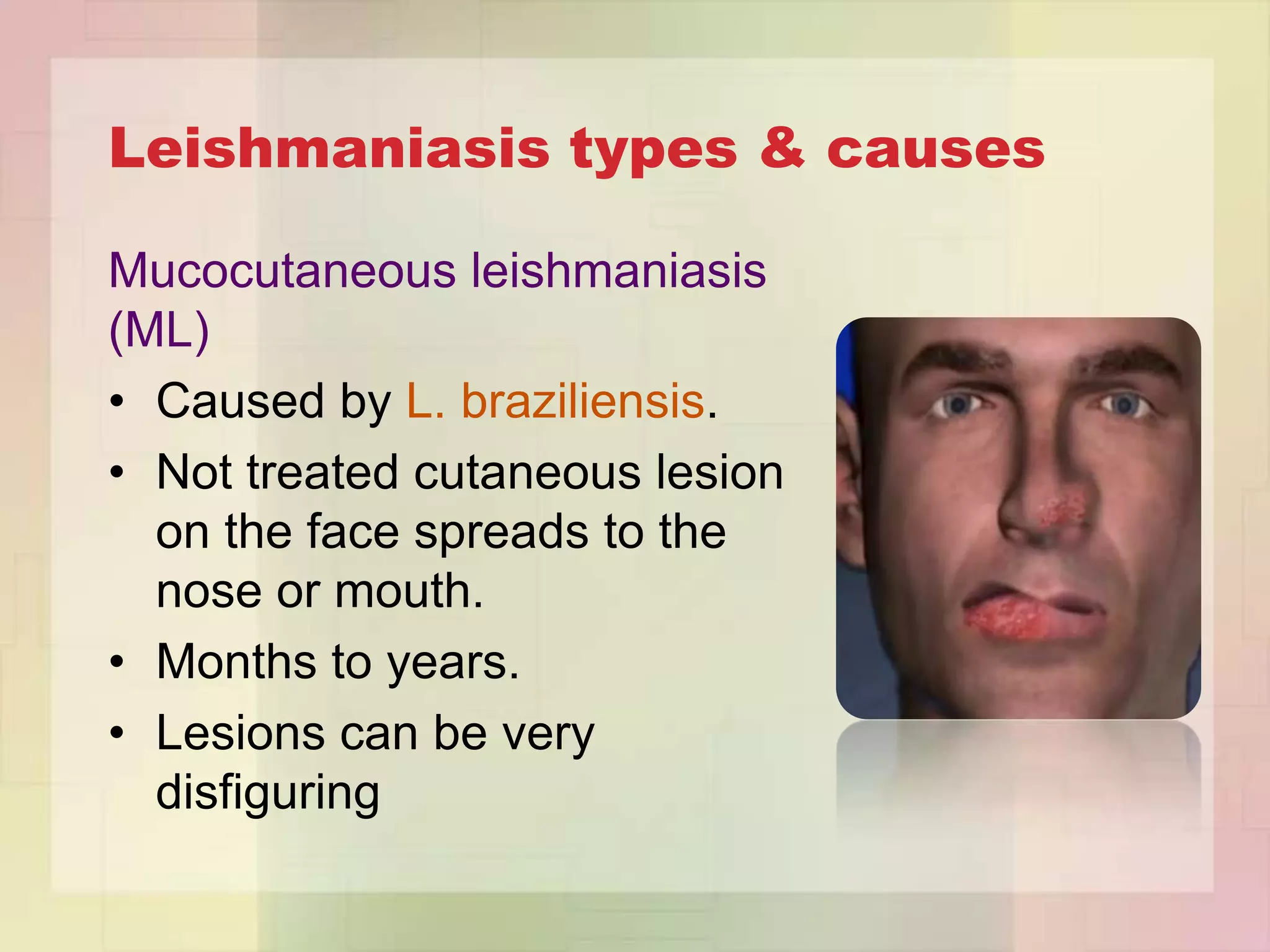Leishmaniasis | PPTX