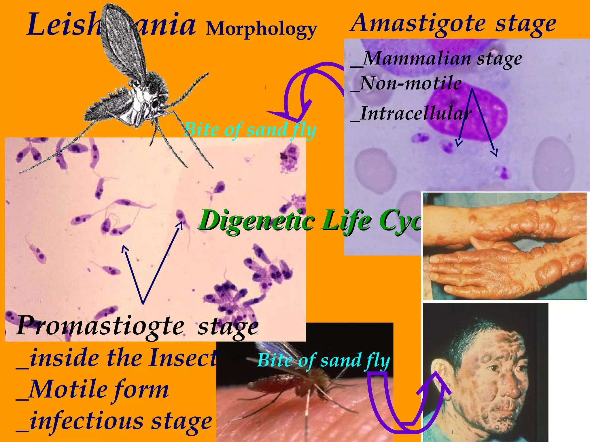 Leishmaniasis | PPT