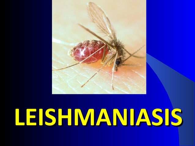 Leishmaniasis.pptx