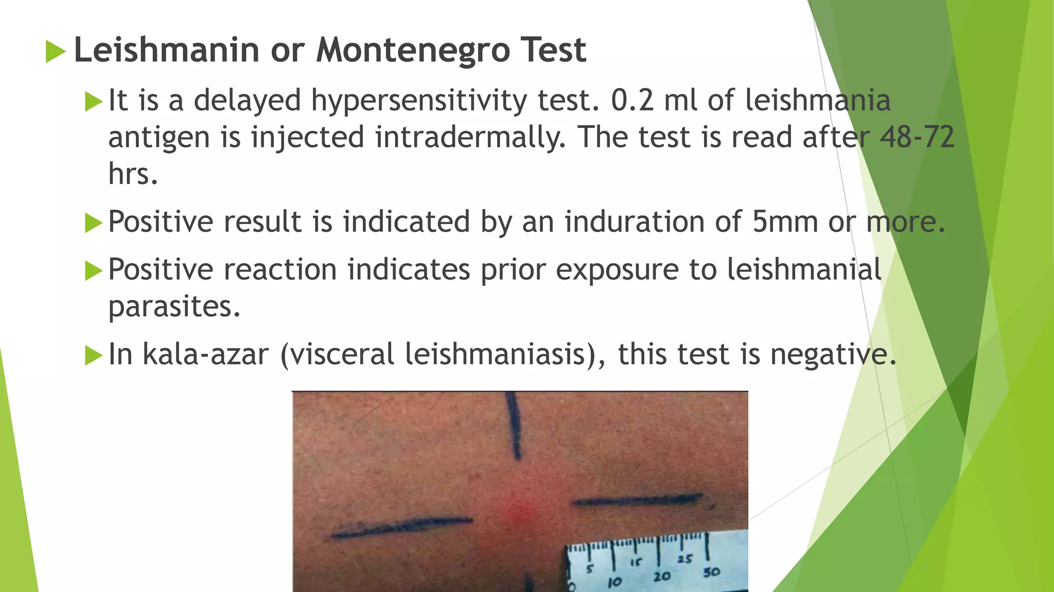 Leishmaniasis | PPTX