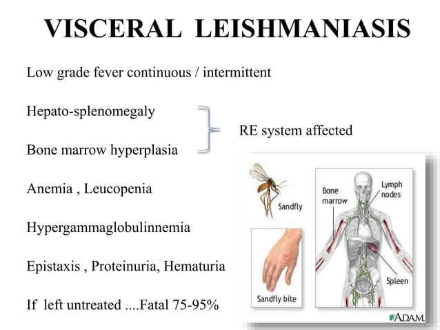 Leishmania ,the parasite, Disease and Management | PPTX