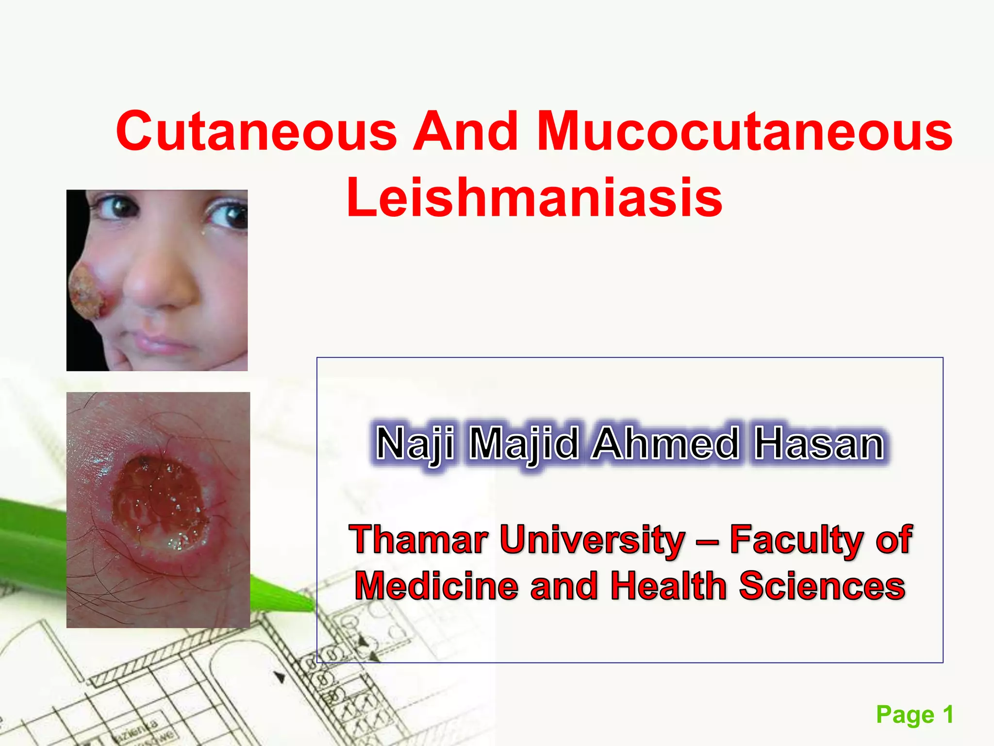 Leishmaniasis | PPT